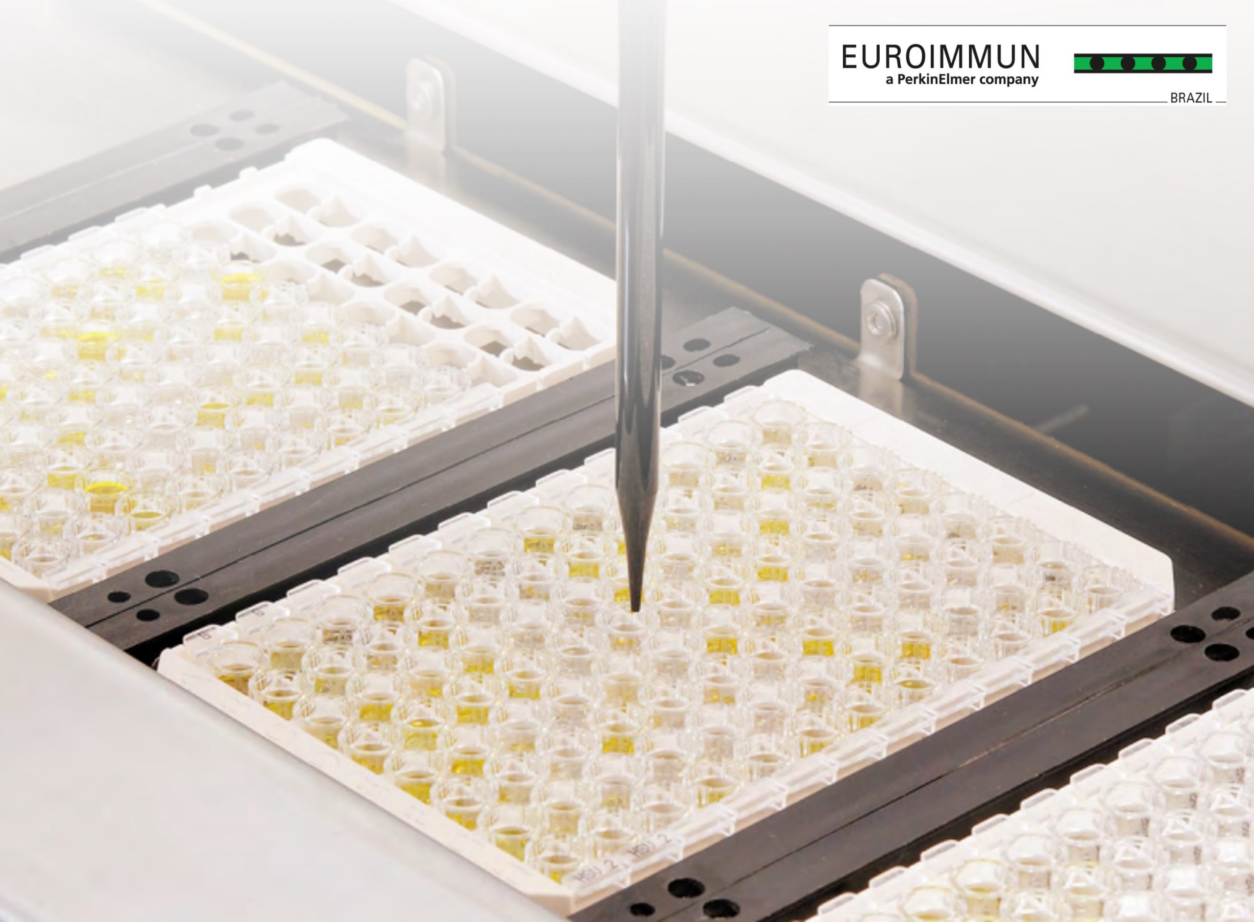 Anti-ENA Pool Plus ELISA | Guia Laboratorial